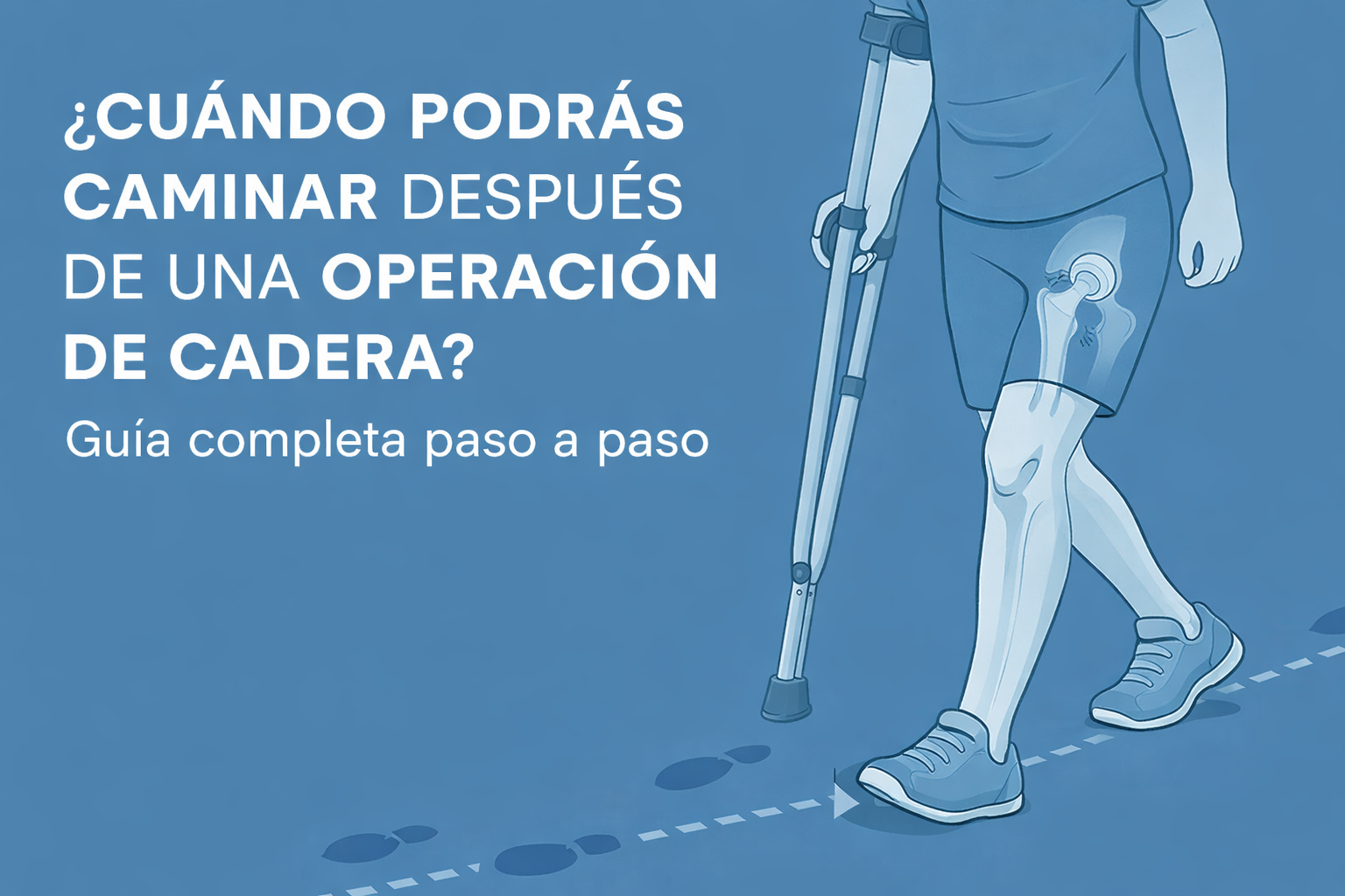 Volver a caminar tras una prótesis de cadera: tiempos y consejos - Hip ...